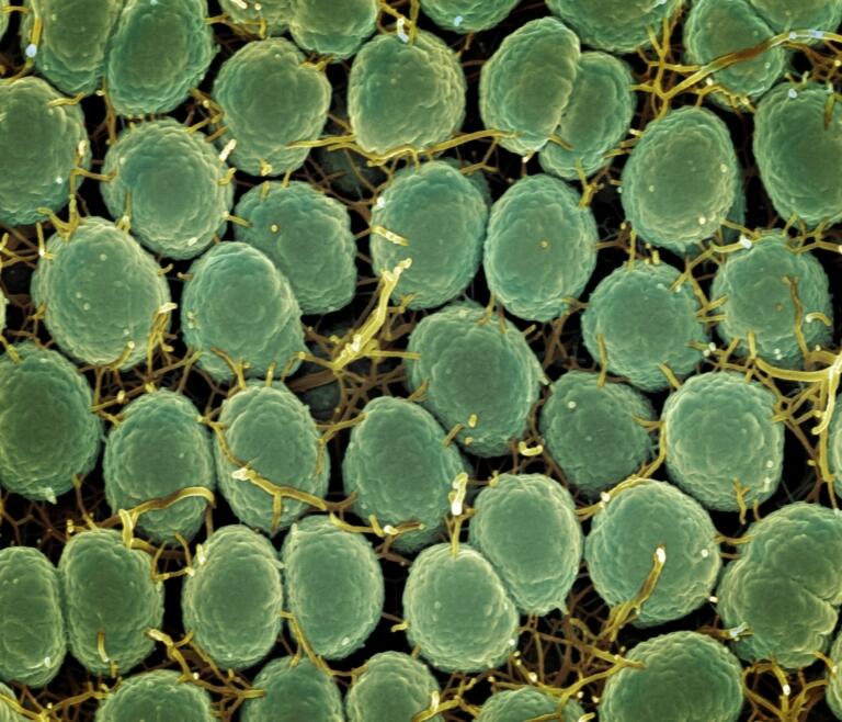 Reino protista: características, clasificación, ejemplos y tipo de célula