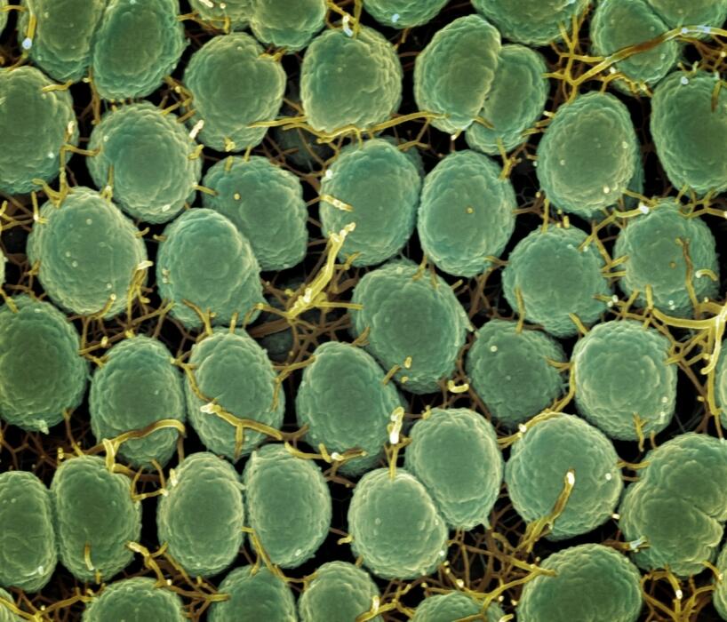 Reino protista: características, clasificación, ejemplos y tipo de célula