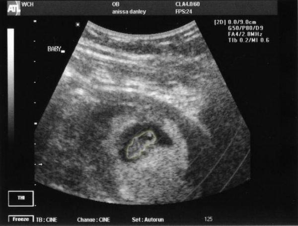 GCSE Biology Revision: Reproduction In Humans